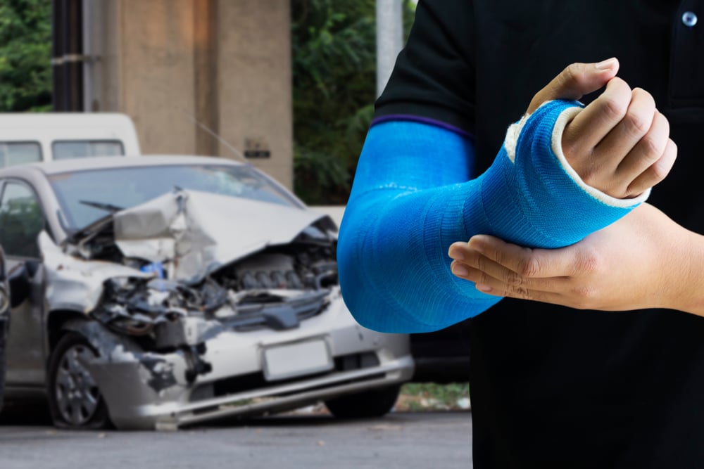 How Long Do Bone Fractures After An Accident Take To Heal Factors To How Long Do Bone Fractures After An Accident Take To Heal Factors To